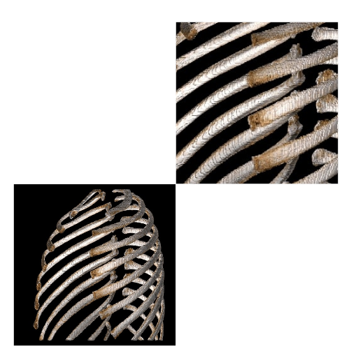 VTK缩放图像与提取ROI(vtkImageChangeInformation与vtkExtractVOI)_vtk extractvoiexample-CSDN博客