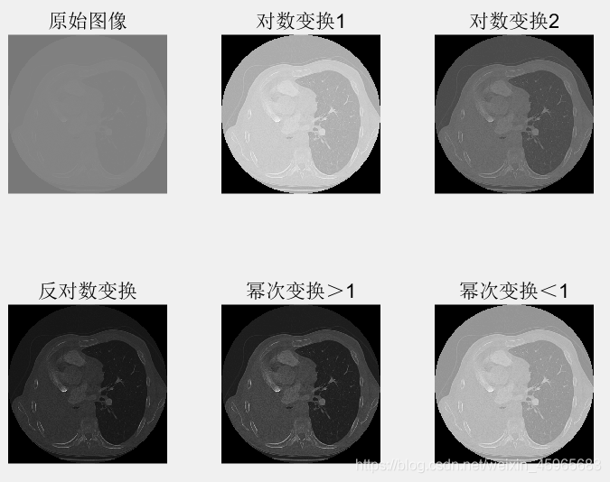MATLAB学习之图像增强、线性运算、非线性运算、CT图像的开窗显示_matlab图像开窗变换-CSDN博客