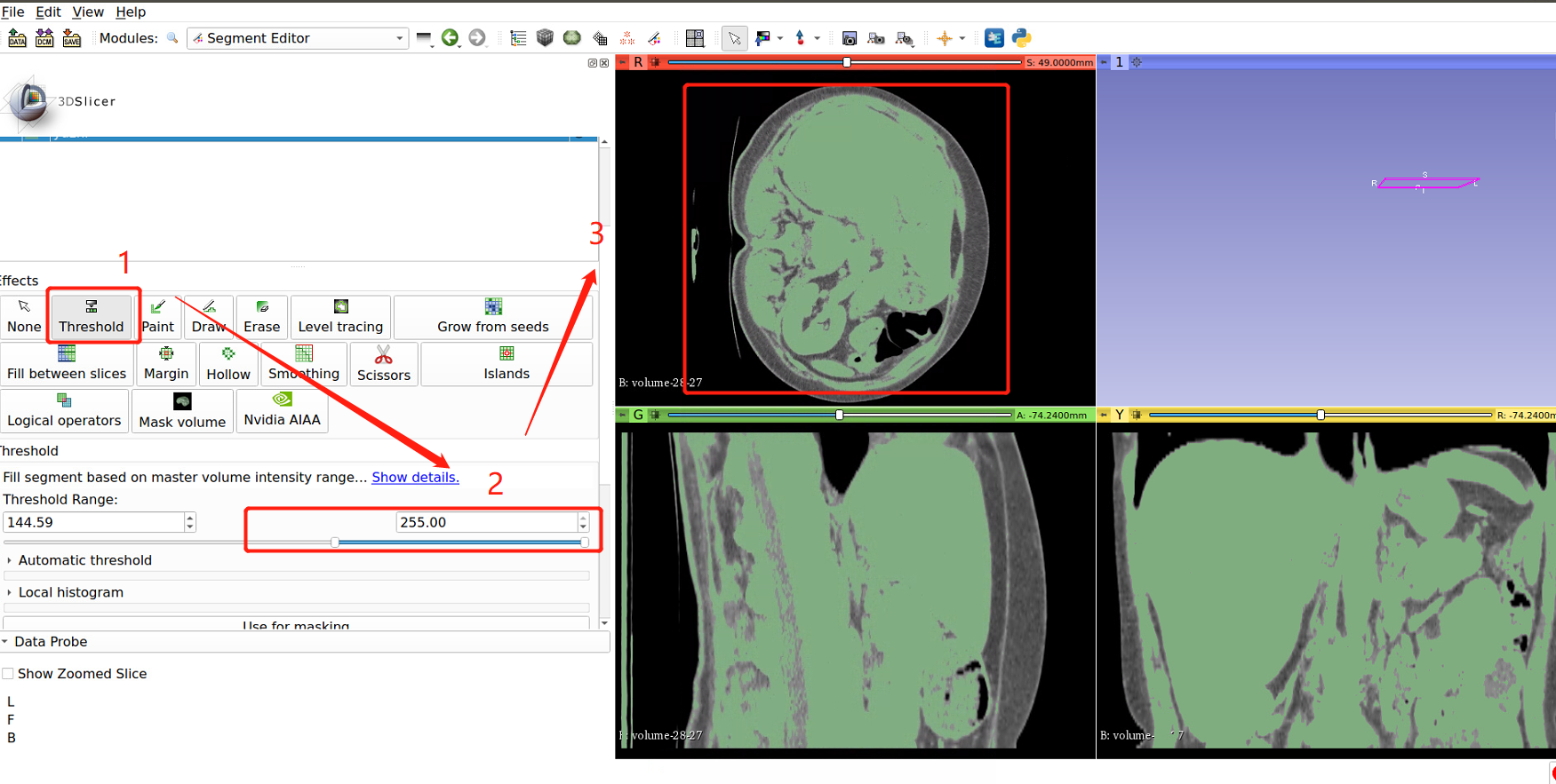 3D Slicer简单三维重建_3dslicer三维重建-CSDN博客