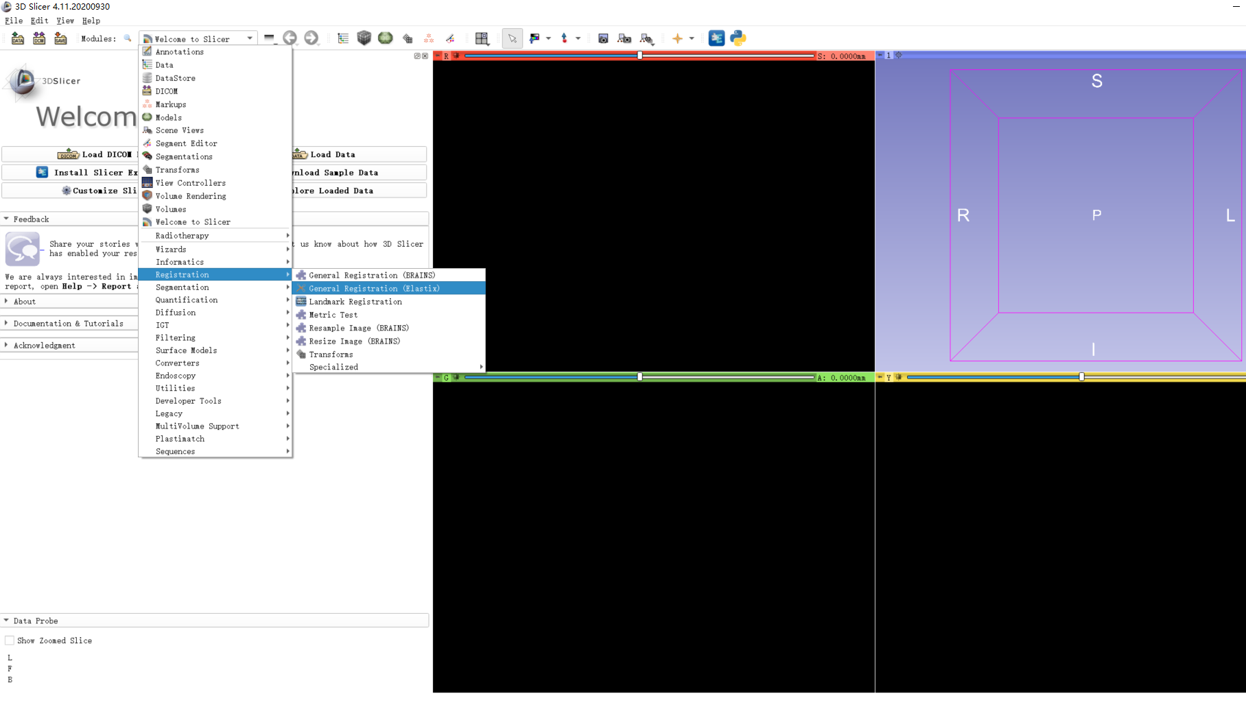 3D Slicer——配准篇(基于Elastix形变配准)详细教程_3d slicer elastix-CSDN博客