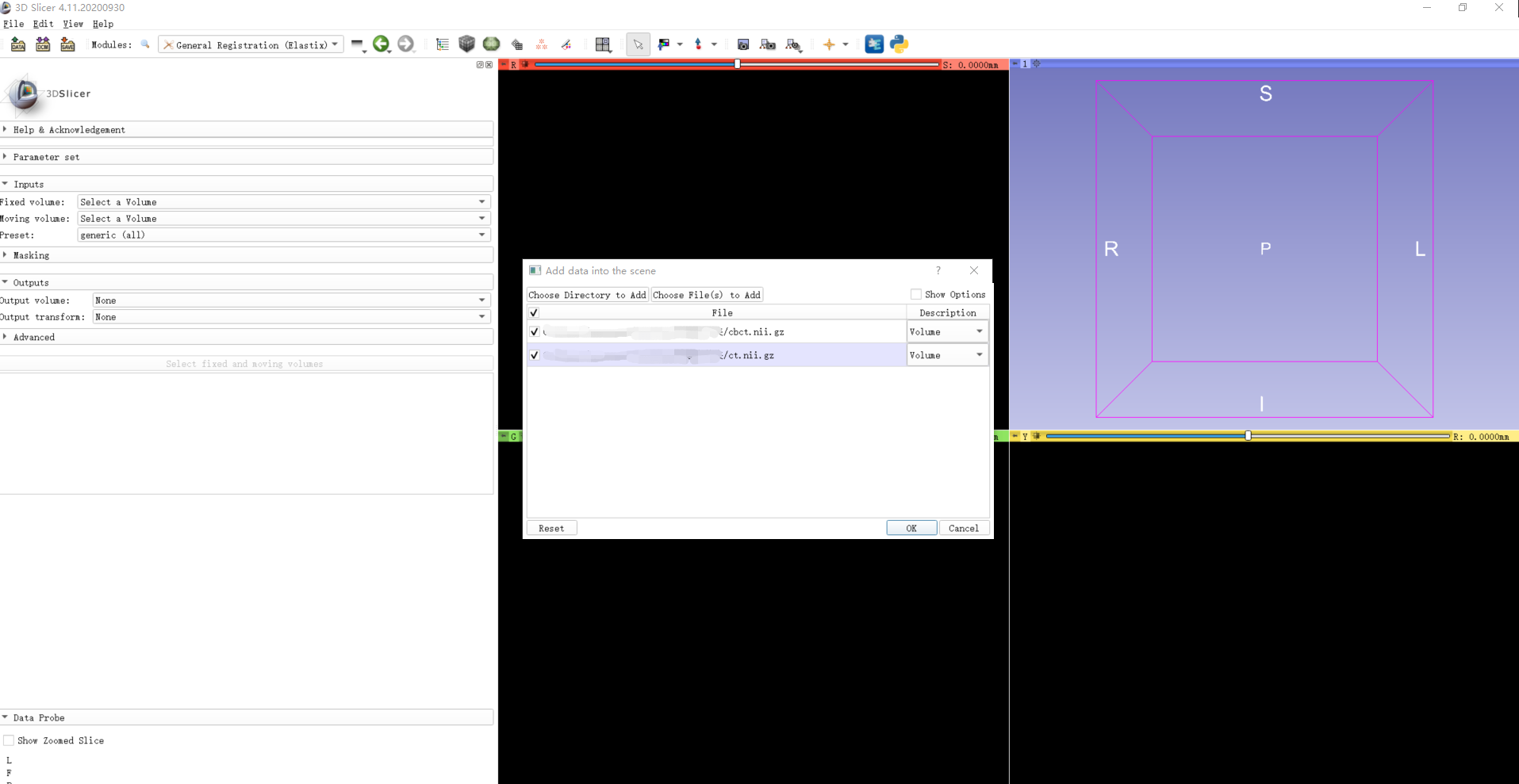 3D Slicer——配准篇(基于Elastix形变配准)详细教程_3d slicer elastix-CSDN博客