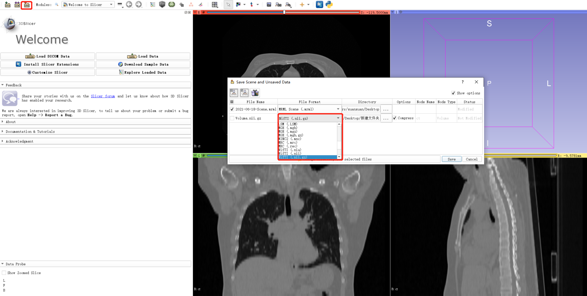 3D Slicer——配准篇(基于Elastix形变配准)详细教程_3d slicer elastix-CSDN博客