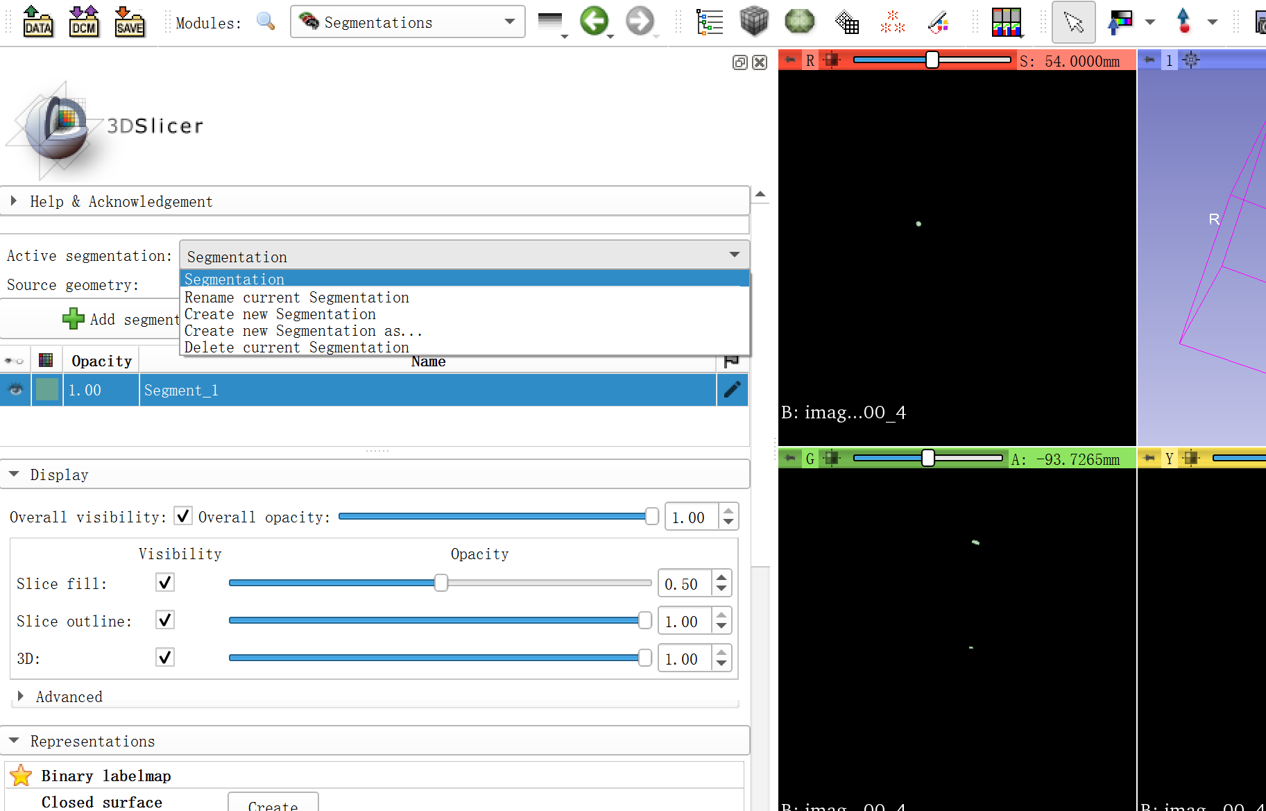 3D slicer 进行三维可视化_3d slicer volumnnode 显示-CSDN博客