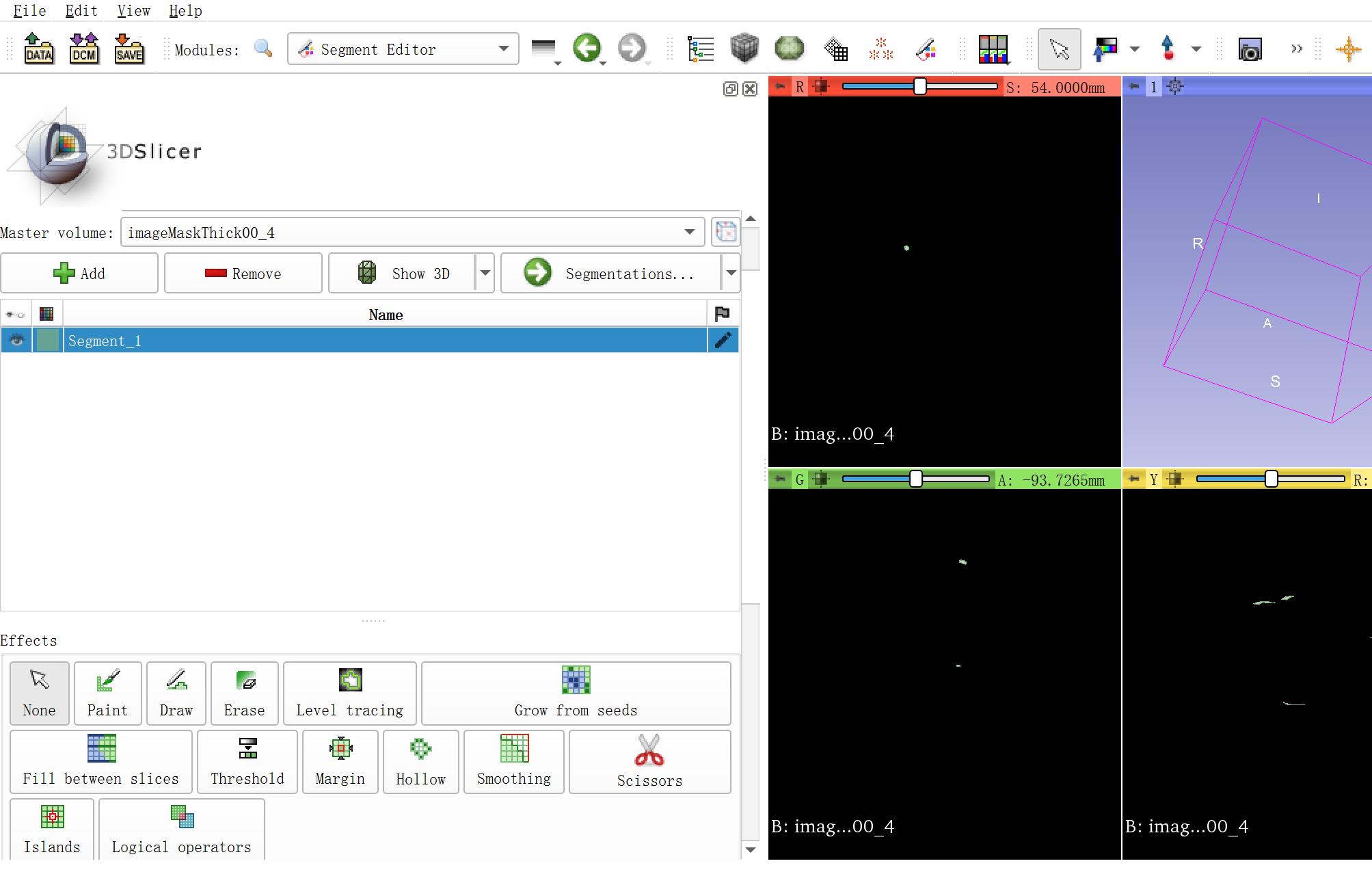 3D slicer 进行三维可视化_3d slicer volumnnode 显示-CSDN博客