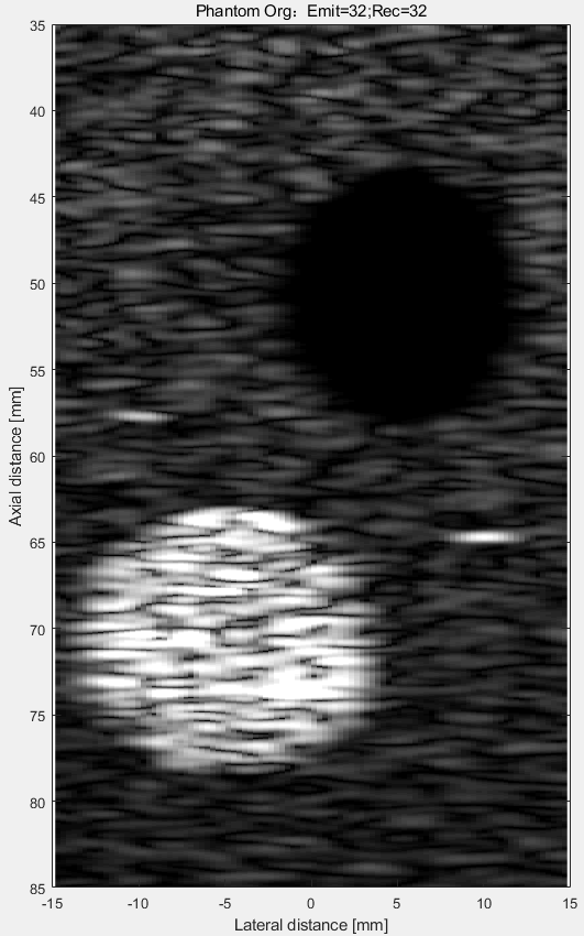 FieldII声学仿真之囊肿仿体生成_field ii-CSDN博客