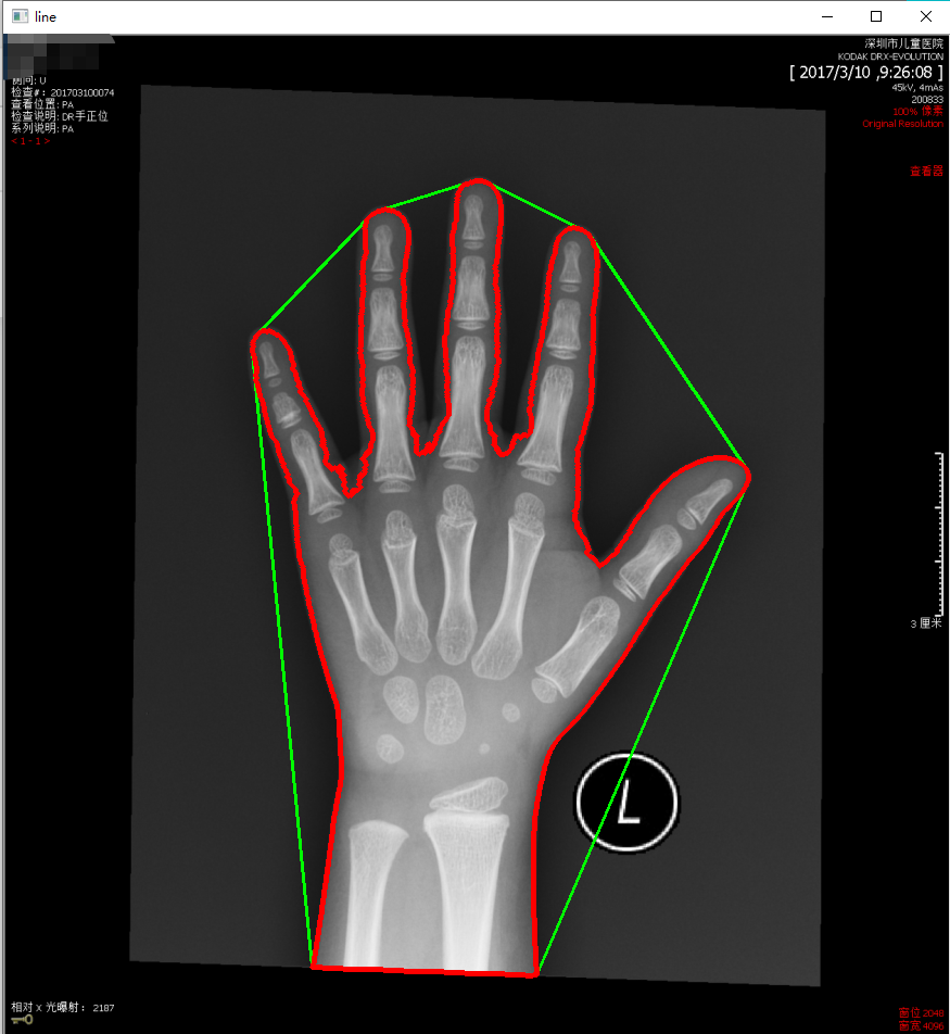 OpenCV——图像轮廓2_cv2.contourarea(i)_Little___c的博客-CSDN博客