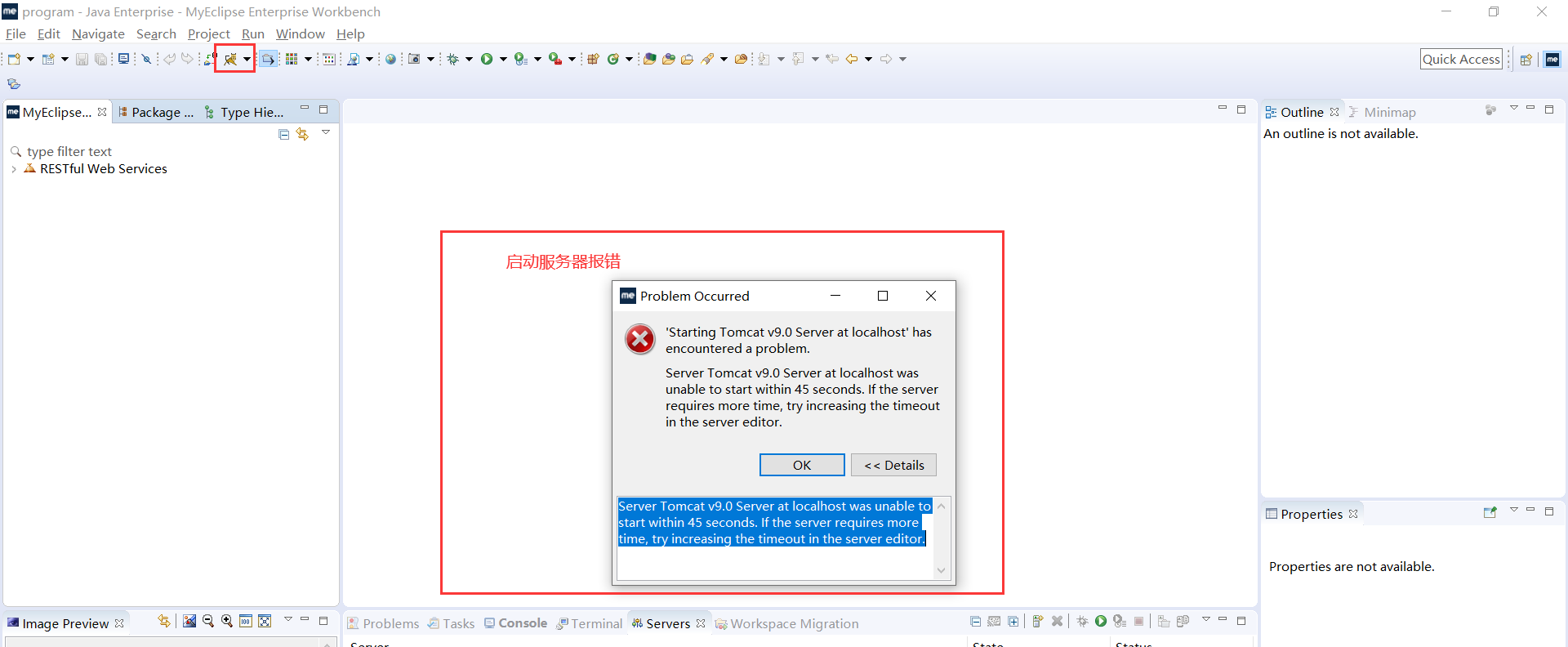MyEclipse整合SSH框架_myeclipse10搭建ssh框架-CSDN博客