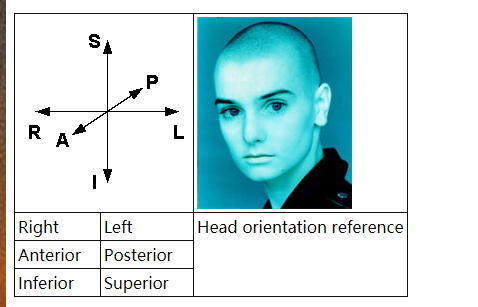 nii文件中的方向理解_simpleitk nii 方向问题-CSDN博客