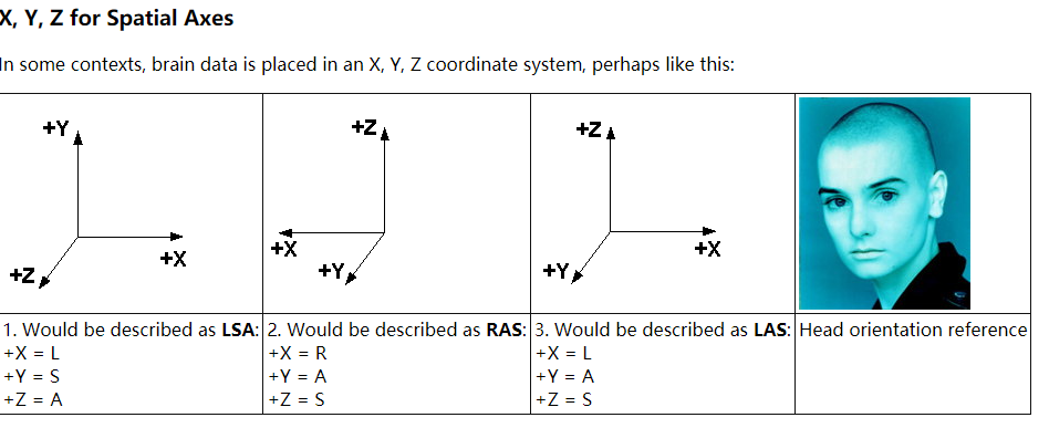 nii文件中的方向理解_simpleitk nii 方向问题-CSDN博客