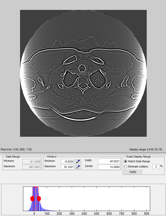 Pytorch实现CT图像正投影（FP）与反投影（FBP）的模块_ct投影域-CSDN博客