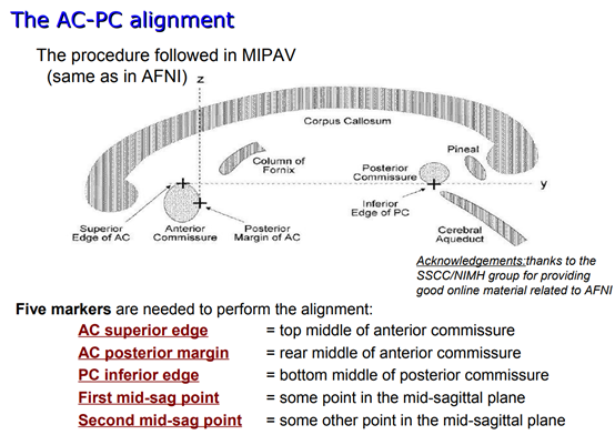 医学图像预处理：MIPAV做脑smri前连合后联合（AC-PC）-CSDN博客