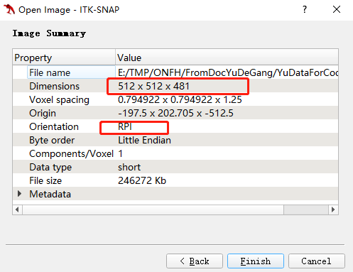 nii文件中的方向理解_simpleitk nii 方向问题-CSDN博客