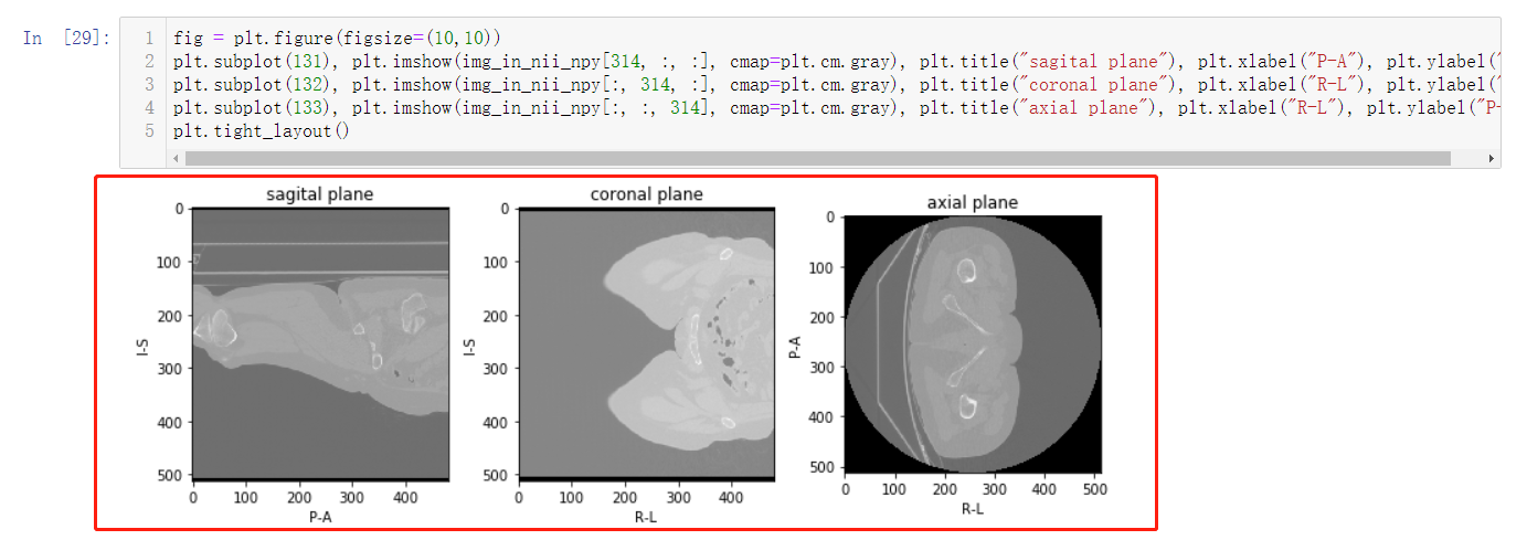 nii文件中的方向理解_simpleitk nii 方向问题-CSDN博客