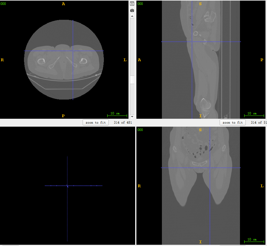 nii文件中的方向理解_simpleitk nii 方向问题-CSDN博客