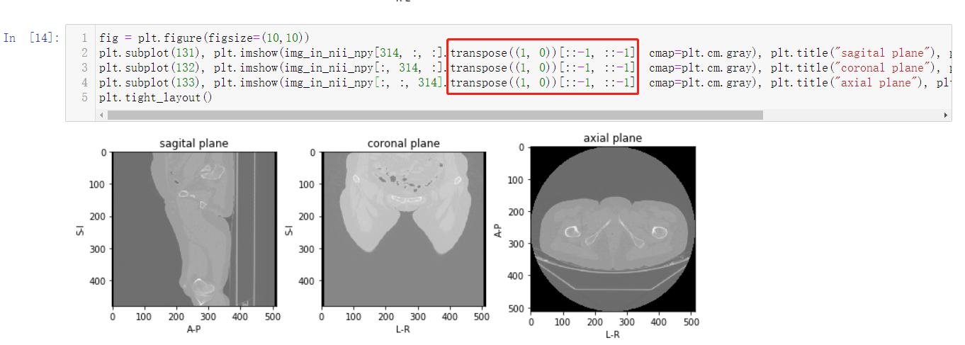 nii文件中的方向理解_simpleitk nii 方向问题-CSDN博客