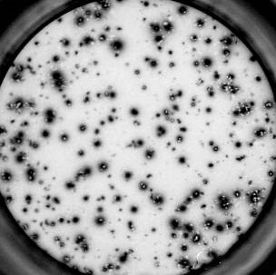 【整理】ELISPOT实验操作及常见问题_②elispot-CSDN博客