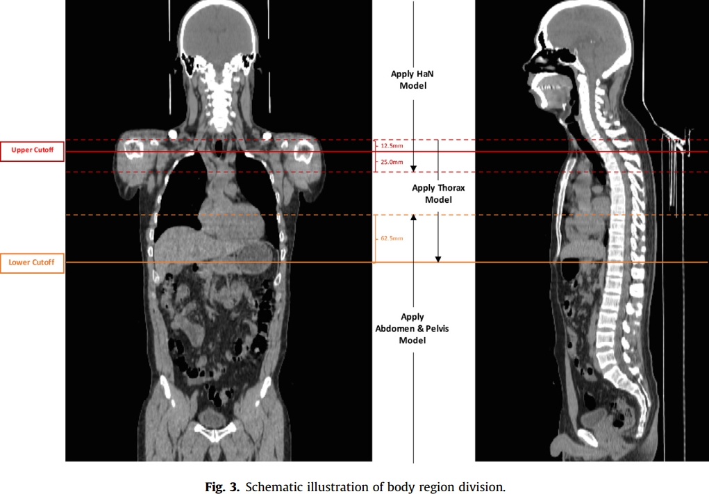A deep learning-based auto-segmentation system for organs-at-risk on ...