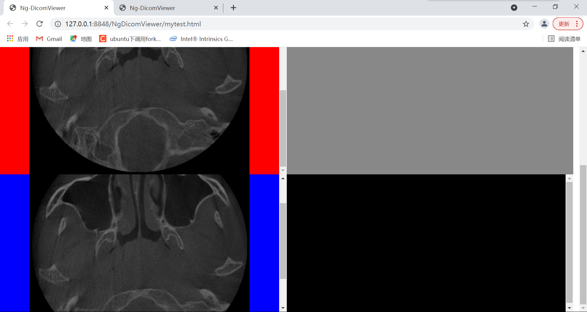 CBCT展示界面_cbct显示-CSDN博客