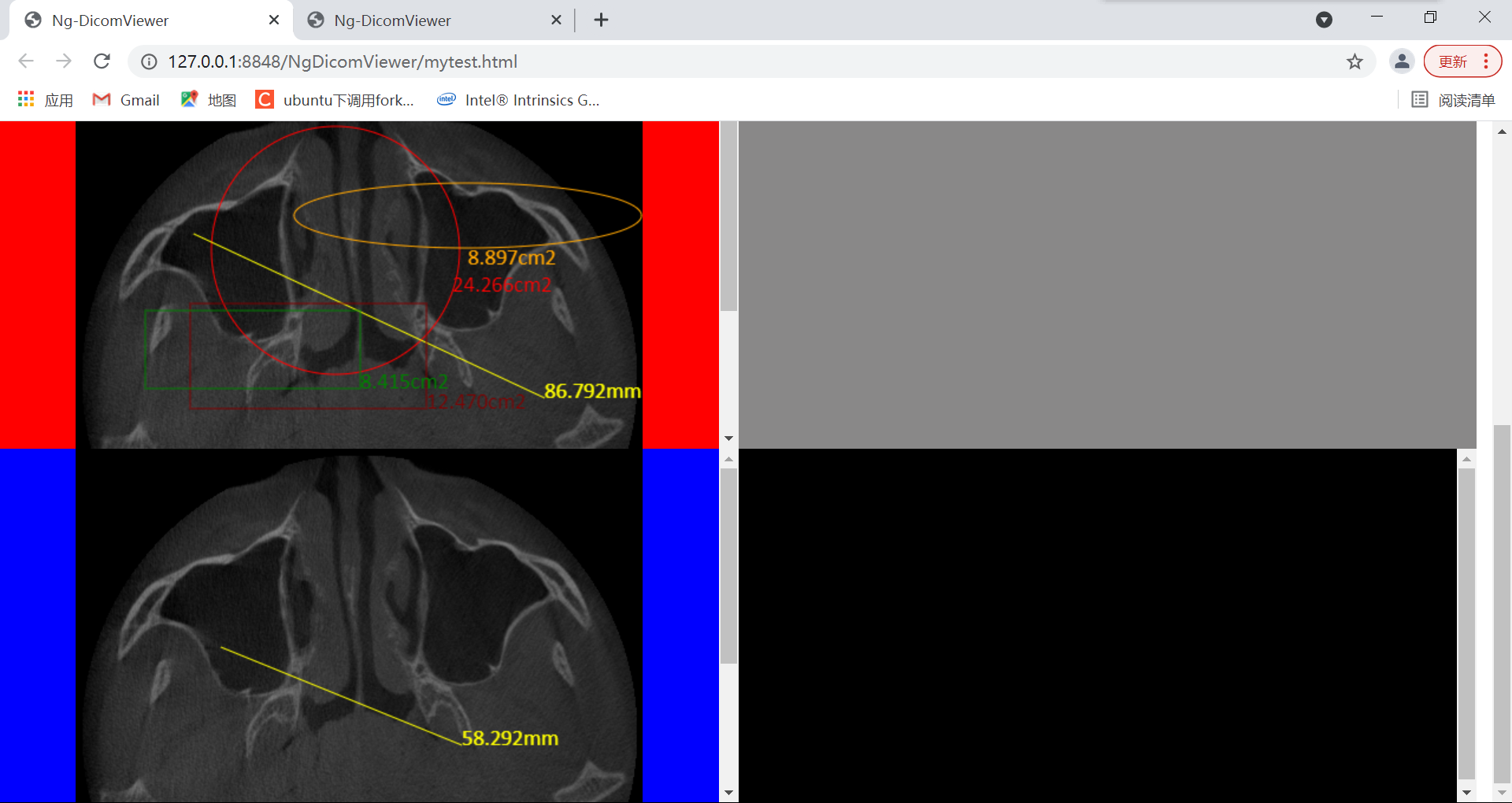 CBCT展示界面_cbct显示-CSDN博客