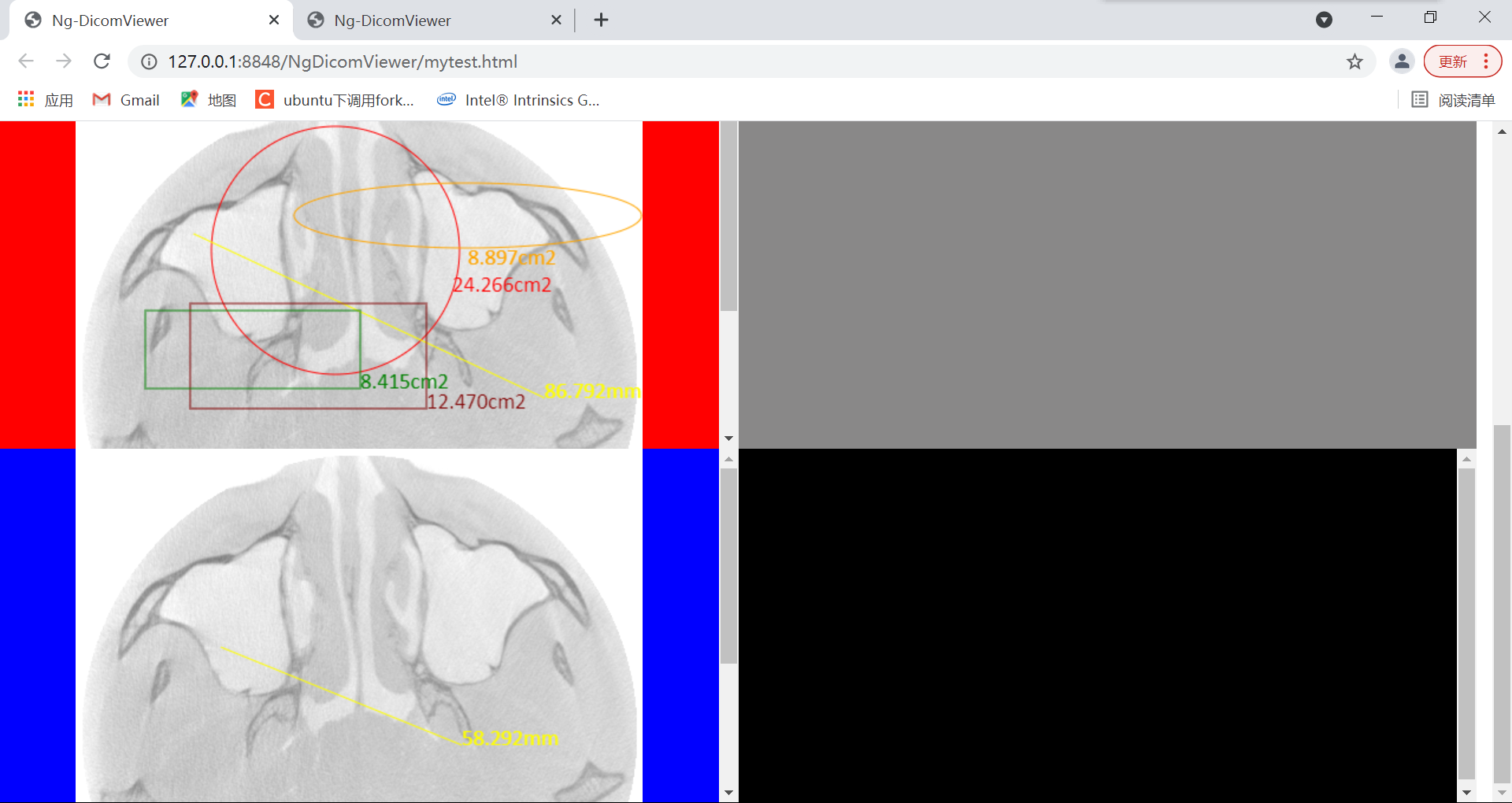 CBCT展示界面_cbct三个面_绊星的博客-CSDN博客