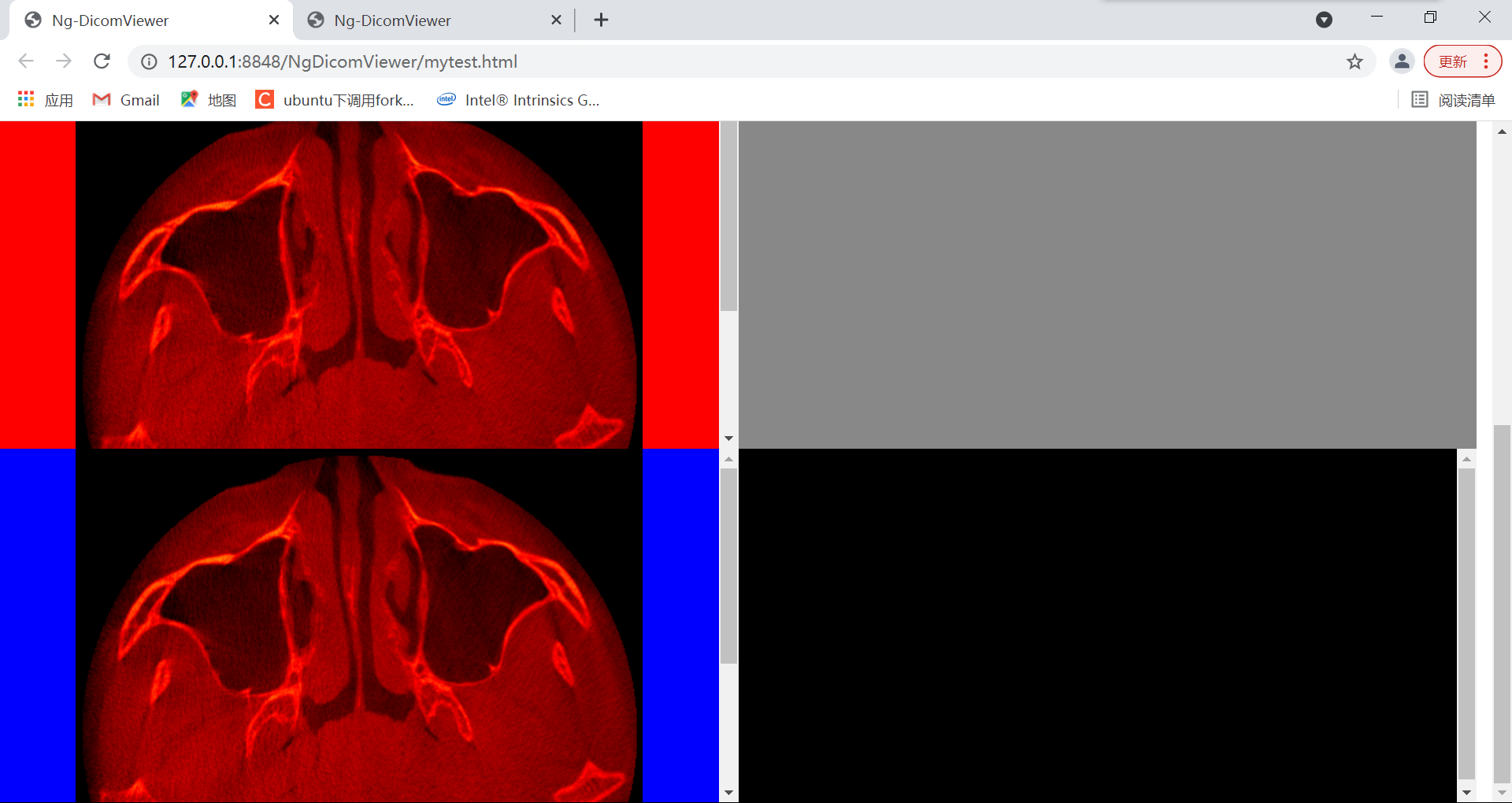 CBCT展示界面_cbct显示-CSDN博客