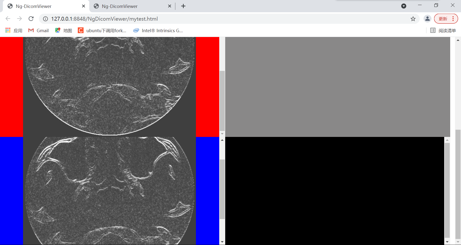 CBCT展示界面_cbct三个面_绊星的博客-CSDN博客