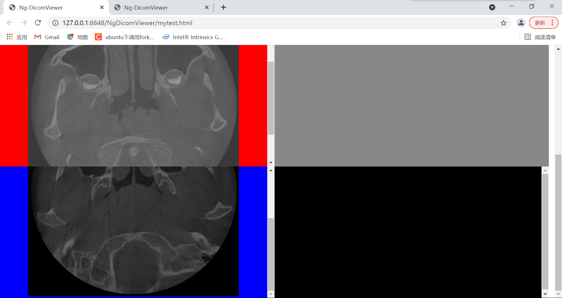 CBCT展示界面_cbct显示-CSDN博客