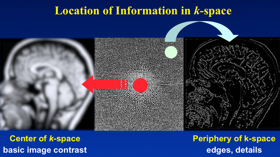 k-space相关_k space point array data-CSDN博客