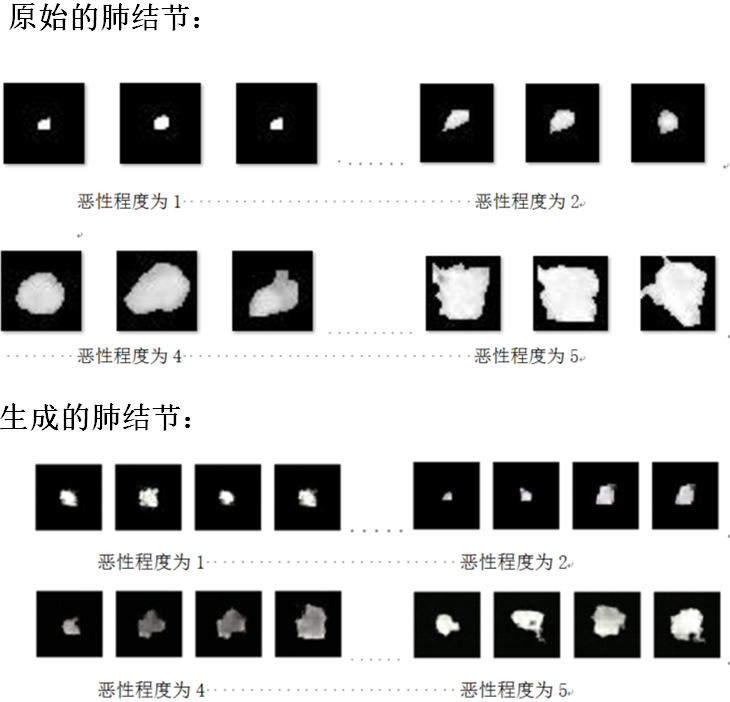 利用深度学习对医学CT图像中(LIDC-IDRI)的肺结节进行良恶性判断2_深度学习肺结节检测评价指标-CSDN博客