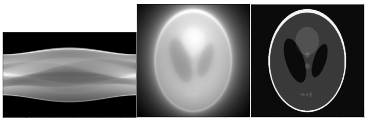 基于Operator Discretization Library (ODL)的CT图像正反投_odl.tomo ...