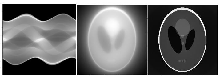 基于Operator Discretization Library (ODL)的CT图像正反投_odl.tomo ...