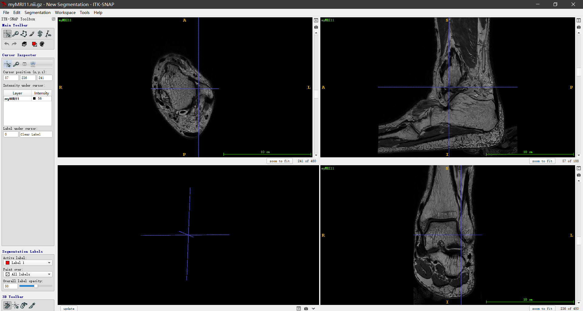 Dicom批量转换为Nifti格式的github小工具使用（命令行方式）-CSDN博客