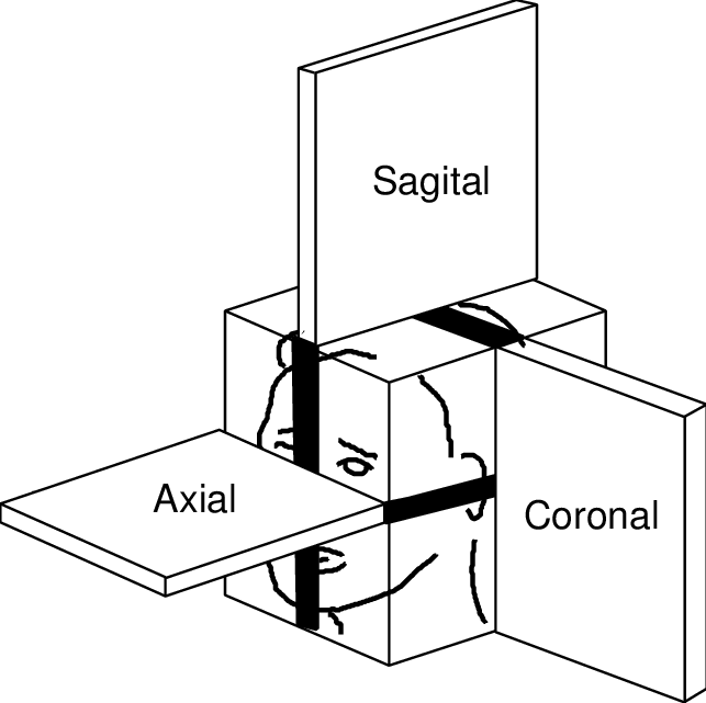 MRI脑影像分析——多种工具实现Nifti(*.nii)文件读取、处理与写入——把小舞写进脑海里、6mm半高全宽高斯核平滑脑影像、NIFTI ...