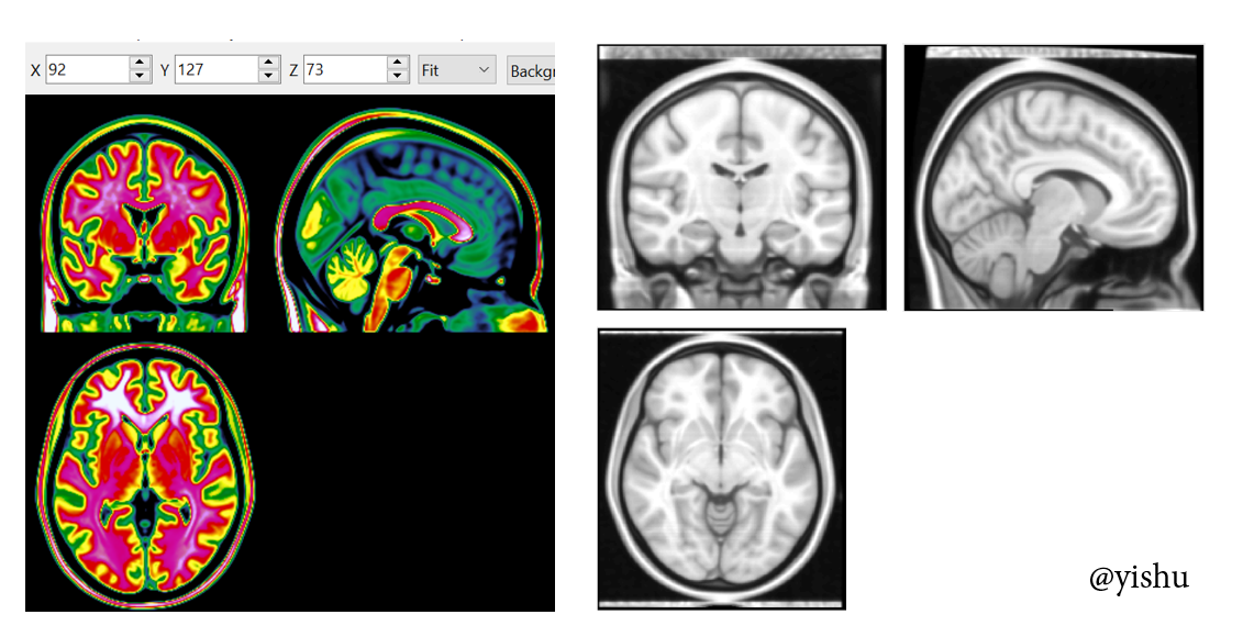 MRI脑影像分析——多种工具实现Nifti(*.nii)文件读取、处理与写入——把小舞写进脑海里、6mm半高全宽高斯核平滑脑影像、NIFTI ...