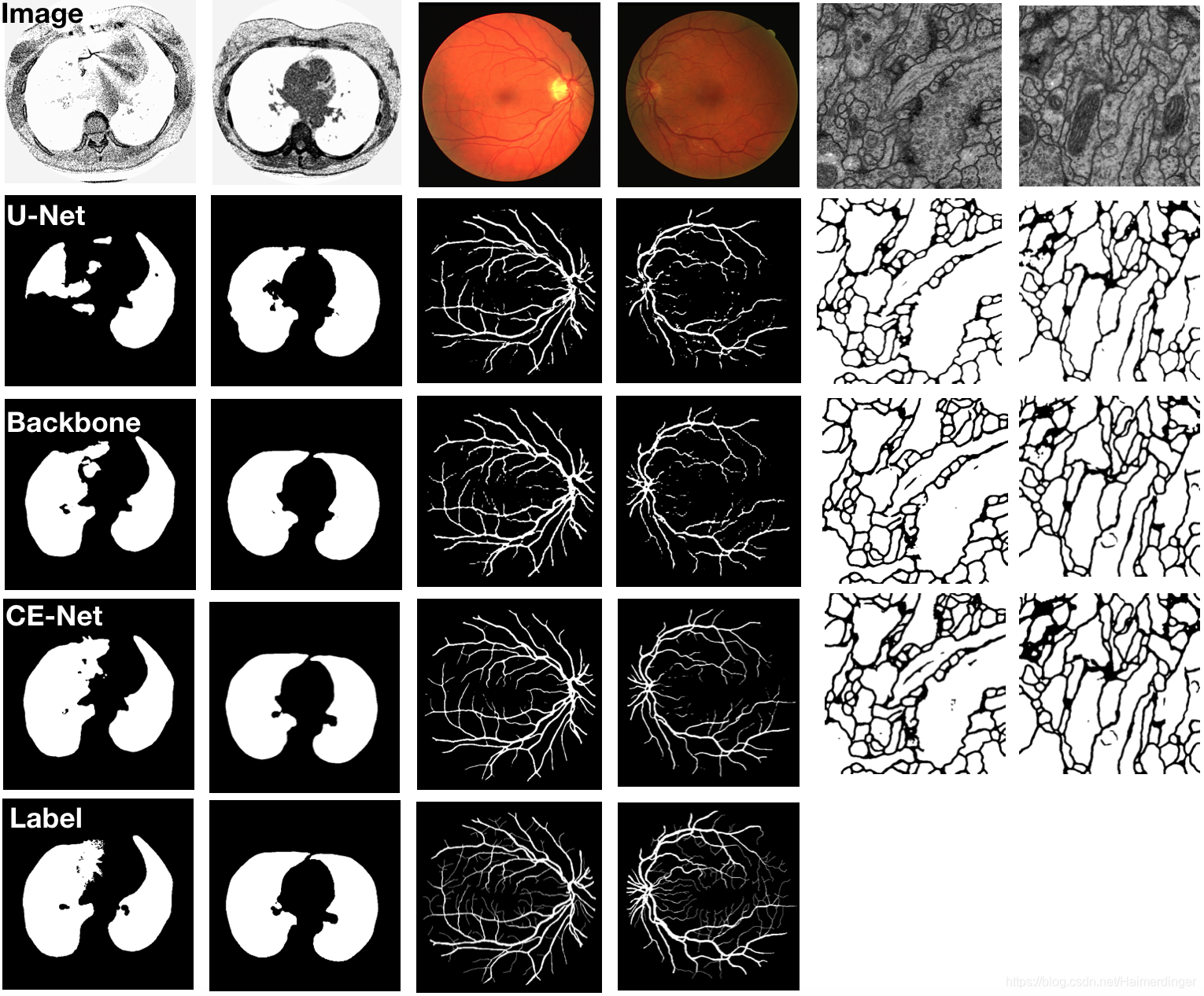 近两年值得阅读的十篇医疗图像分割文献multi Organ Segmentation Over Partially Labeled Da Csdn博客