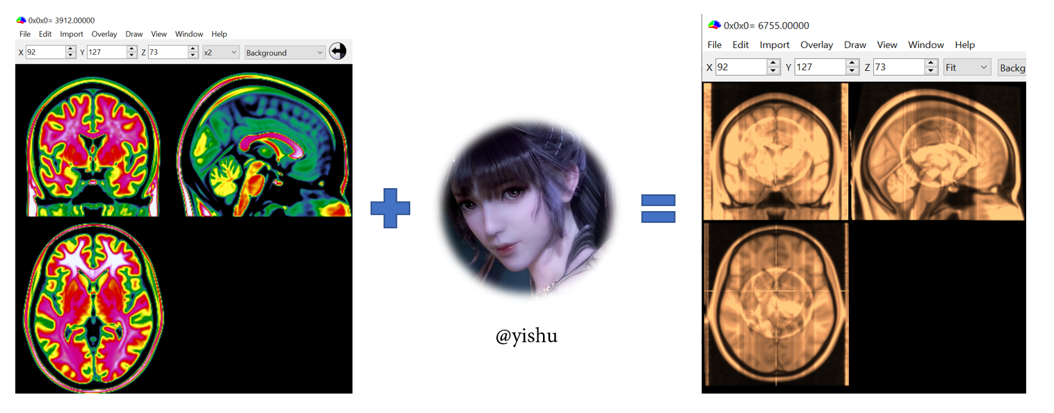 MRI脑影像分析——多种工具实现Nifti(*.nii)文件读取、处理与写入——把小舞写进脑海里、6mm半高全宽高斯核平滑脑影像、NIFTI文件合并、算fMRI平均图像_dpabi生成的nii ...