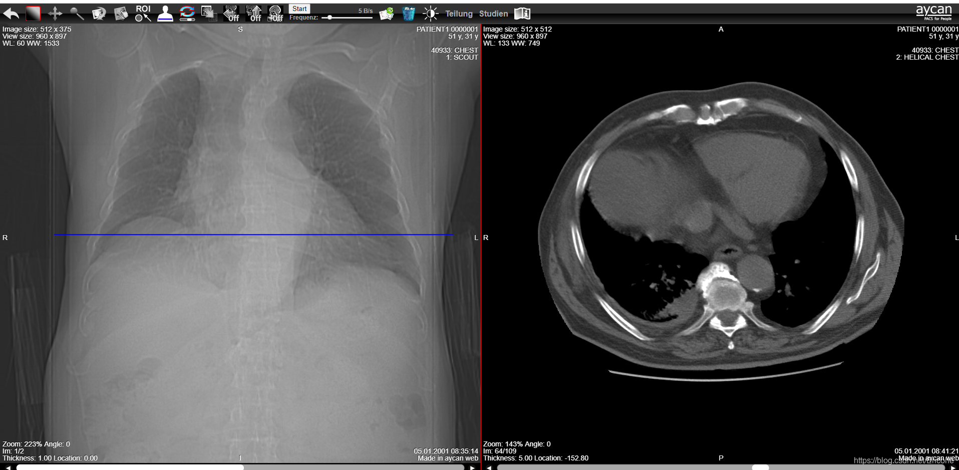 Web Dicom Viewerdicom Web Viewer Csdn博客