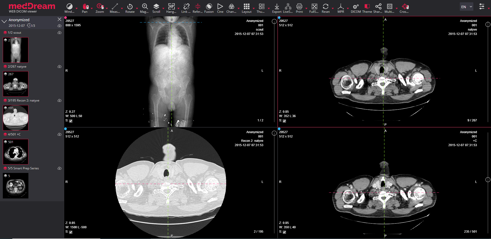 web dicom viewer_dicom web viewer-CSDN博客