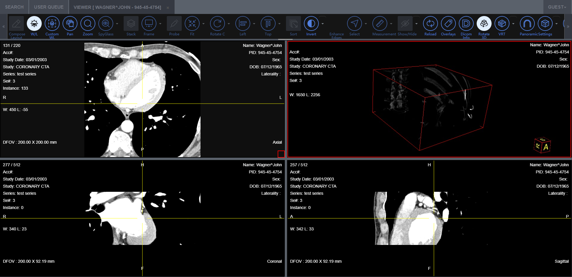 web dicom viewer_dicom web viewer-CSDN博客