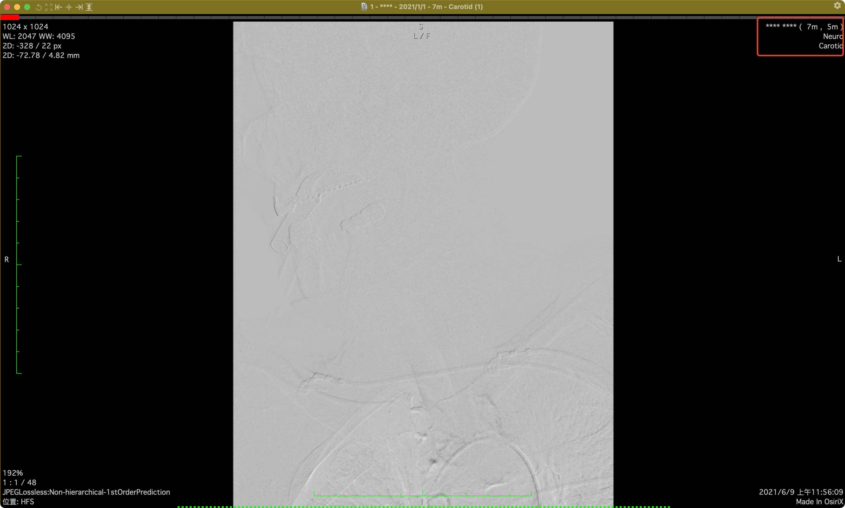 使用 dcm4che 操作 Dicom 文件-CSDN博客