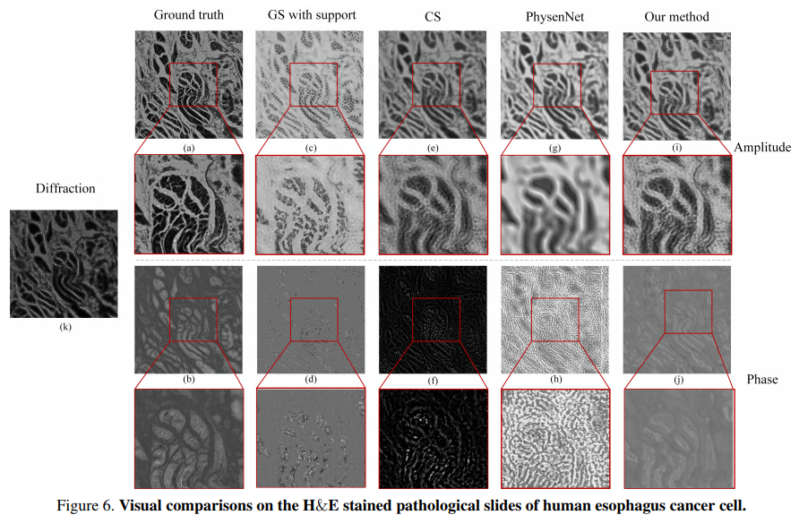 Physics-based Iterative Projection Complex Neural Network for Phase Retrievalin Lensless ...