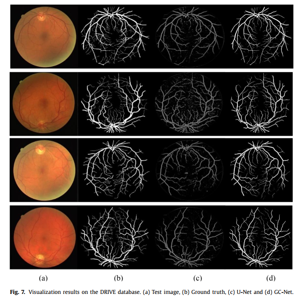 近两年值得阅读的十篇医疗图像分割文献_multi-organ segmentation over partially labeled da-CSDN博客