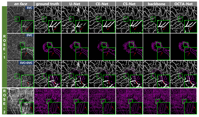 近两年值得阅读的十篇医疗图像分割文献 Multi Organ Segmentation Over Partially Labeled Da Csdn博客