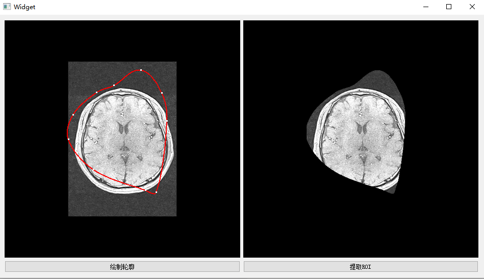 VTK 圈取不规则ROI区域_vtkimagemask-CSDN博客
