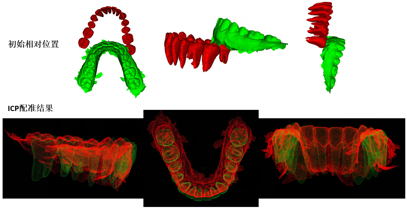 (二) ICP配准方法存在的问题_ipc 配准-CSDN博客