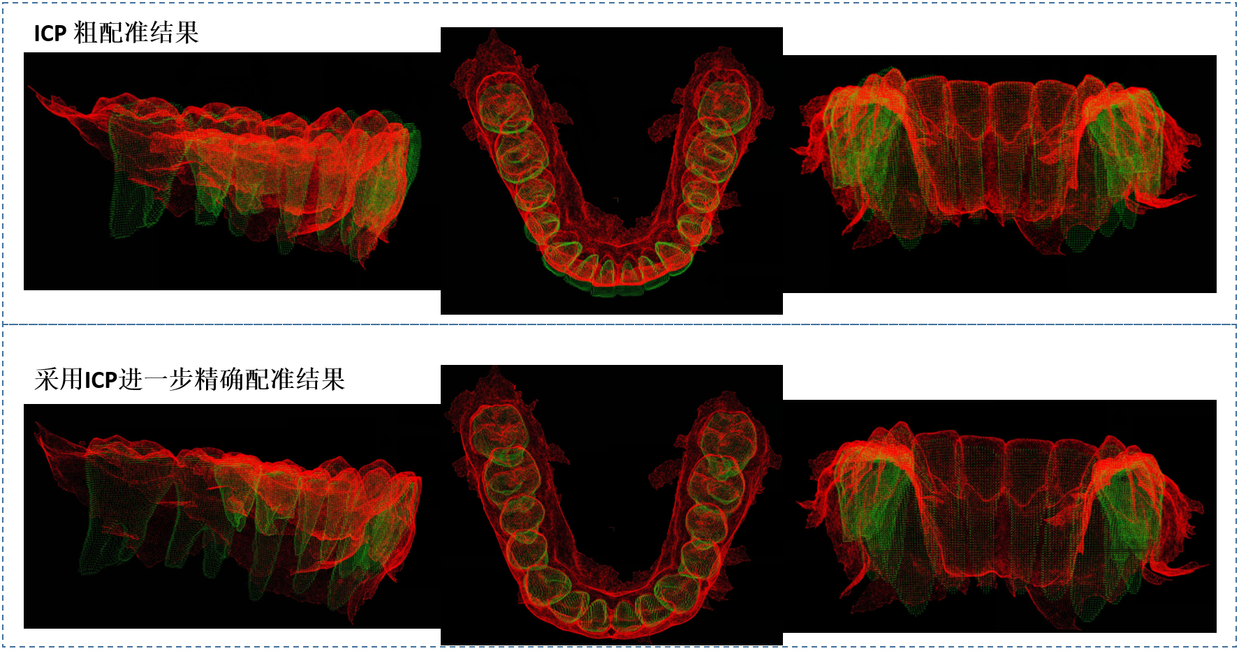 (二) ICP配准方法存在的问题_ipc 配准-CSDN博客