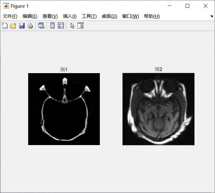 【图像融合】基于nsct-SR+dwt-SR+拉普拉斯金字塔算法-SR等多种图像融合算法matlab源码_nsct 代码-CSDN博客