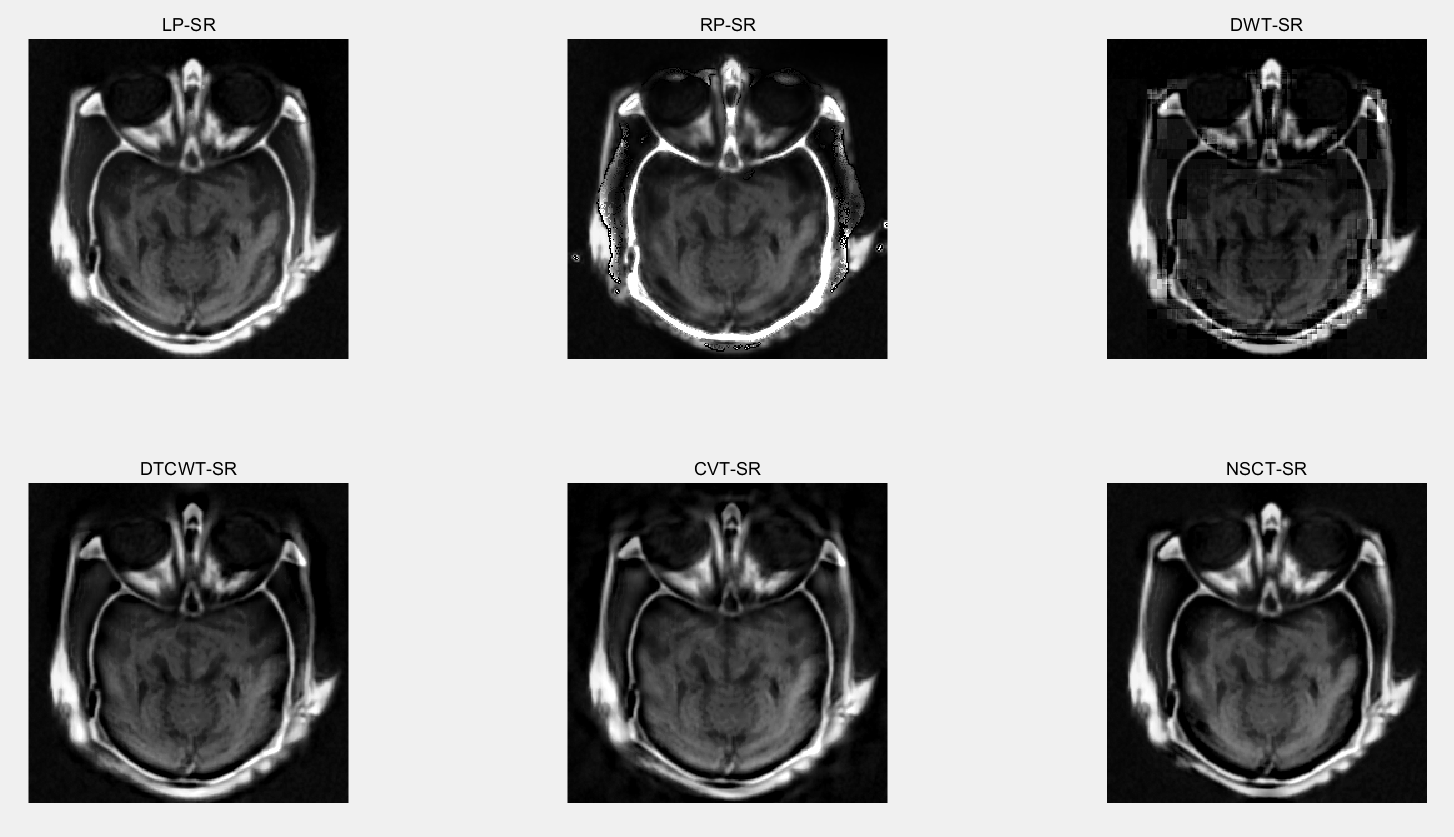 【图像融合】基于nsct-SR+dwt-SR+拉普拉斯金字塔算法-SR等多种图像融合算法matlab源码_nsct 代码-CSDN博客