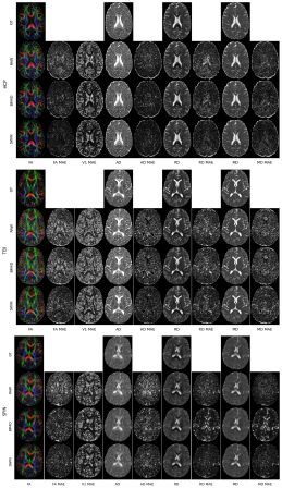 Generalized Diffusion MRI Denoising and Super-Resolution using Swin Transformers_swin ...