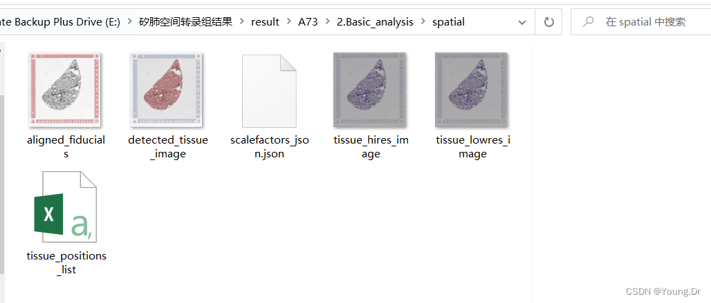 scanpy 空转数据结构seurattoscanpy spatial_scanpy 读取空转-CSDN博客